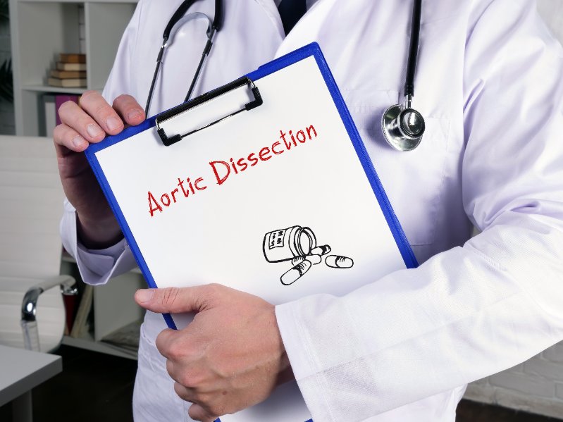 Dissection aortique aiguë : Causes, Symptômes, Traitement - Esculape